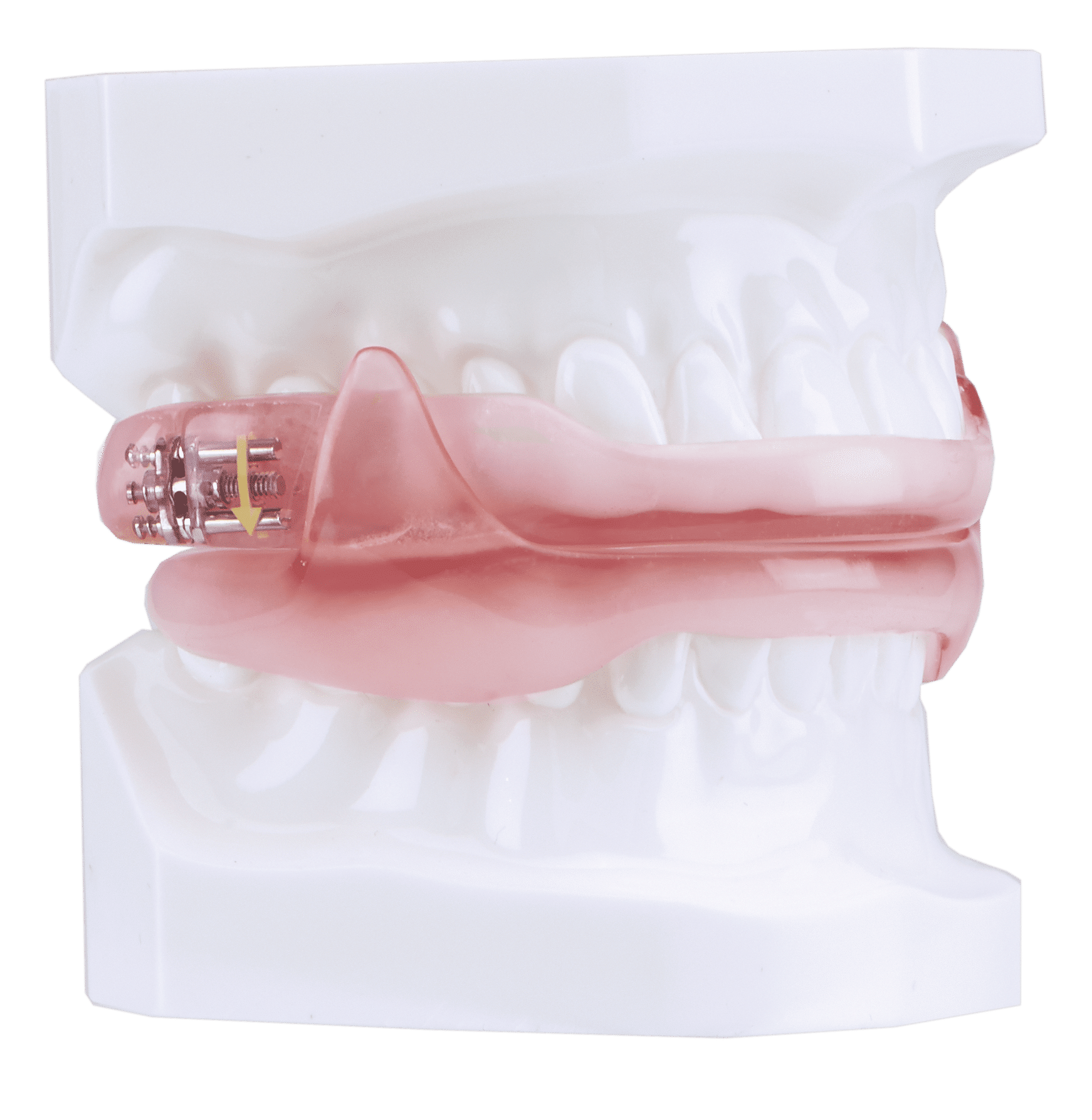 Sleep Apnea Treatment in DeSoto, TX – DeSoto Family Dentistry